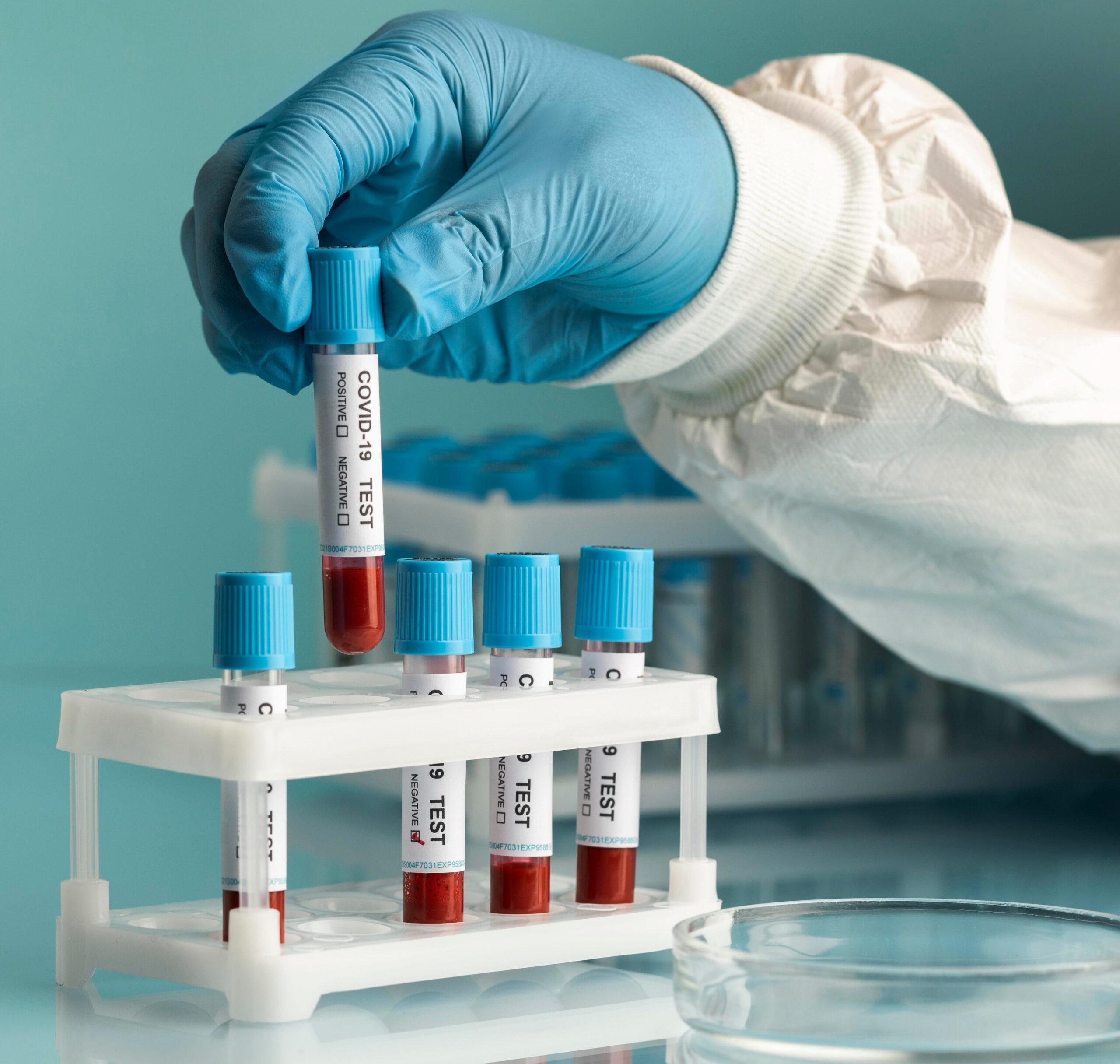 Biochemistry Tests – Nova Meditech Laboratory